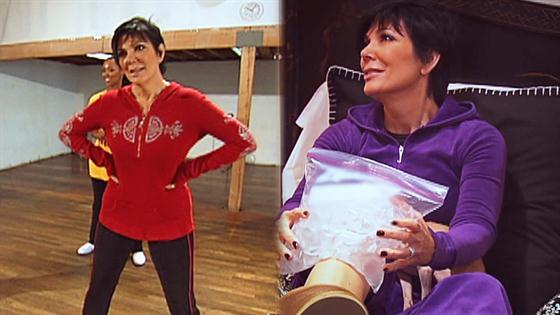 Kris Jenner's PAINFUL Cheerleading Injury