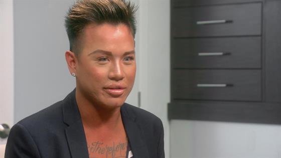 Botched Patient Is Obsessed With Big Doll Like Lips E Online