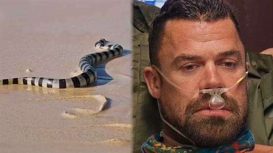 ‘Survivor’ 49’s Jake Latimer Details Recovery After Being Bit by Venomous Snake