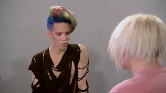 "Botched" Patients Bond Over Nose Issues