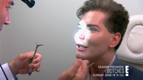 Botched | E! News Canada