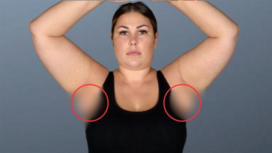 Samantha's Extra Armpit Breasts | Botched | E!