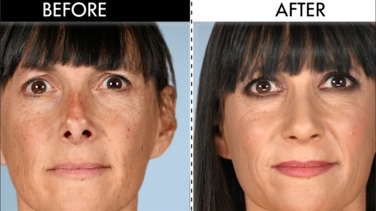 Botched Recap Season 4, Ep. 2 | E! News