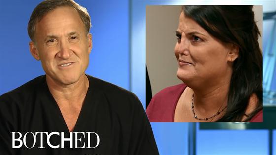 The Riskiest Plastic Surgeries on "Botched"