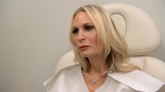 "Botched" Recap: Season 4, Episode 13