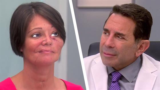 5 Most Supportive "Botched" Families